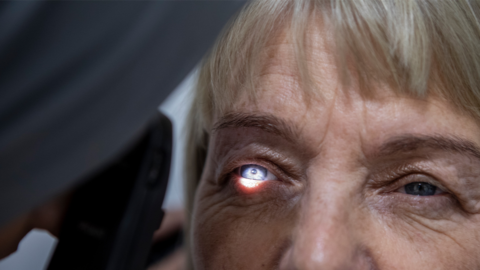 Transforming eye care for older people for better health