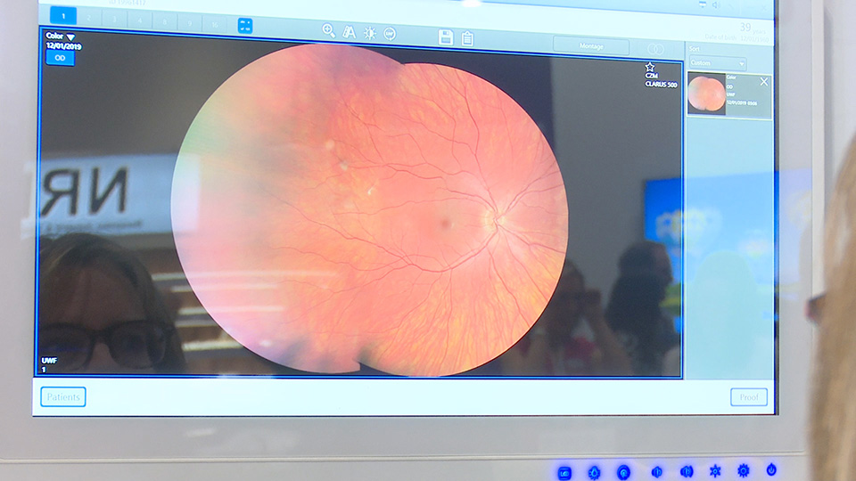 The importance of ultra-wide field imaging