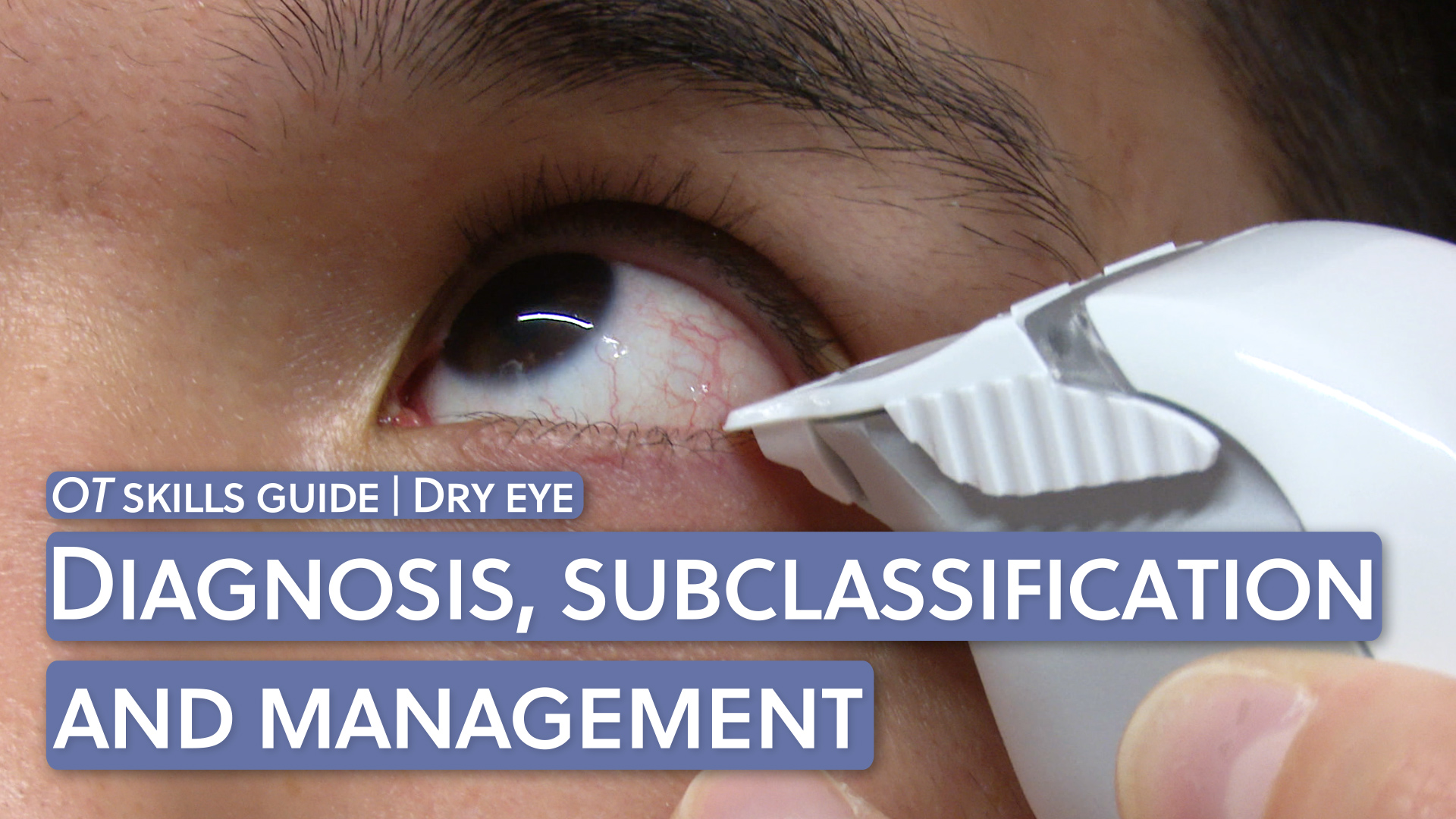 Dry eye: investigative techniques