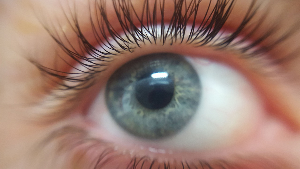 Flashes and floaters - eye health advice